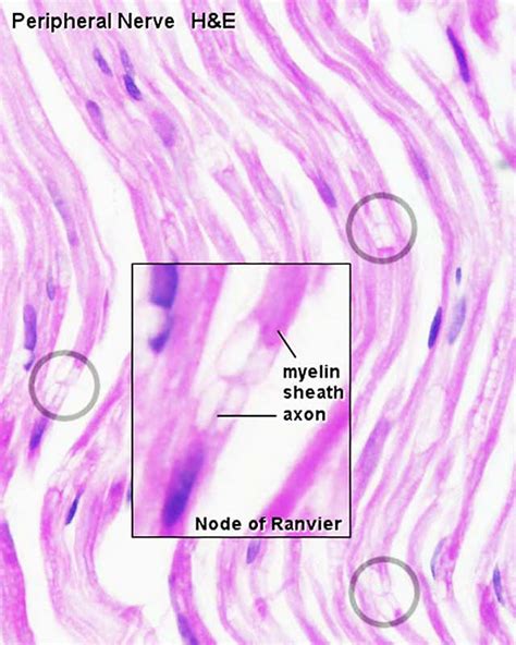 Myelinated Axon Histology