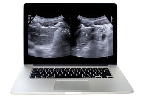 150 Fundus Of Gallbladder Foto Foto Stok Potret And Gambar Bebas Royalti Istock