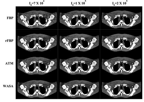 Slice 2 Of Phantom Reconstructed Using Different Methods From The 1st Download Scientific