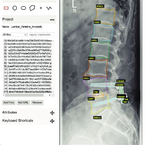 Screenshot Of The Via Annotation Tool With Manual Annotations Of A