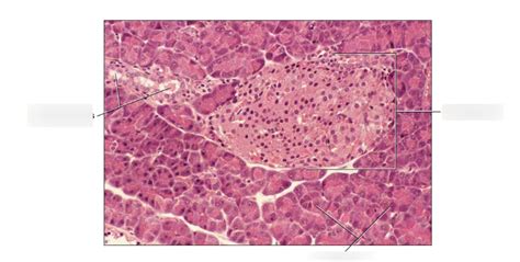 Omtex Classes Draw Neat Labelled Diagram Of The Pancreas