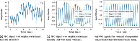 Detrending And Denoising Two Key Steps In The Preprocessing Of A Ppg