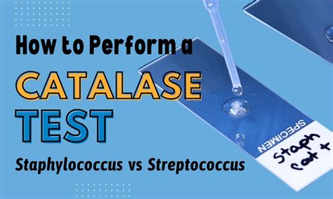 Labtutorial Hardydiagnostics Catalsetest Microbiology Hardy