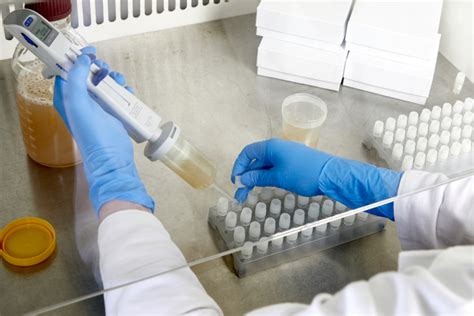 Hansenula Polymorpha ‣ Artes Biotechnology