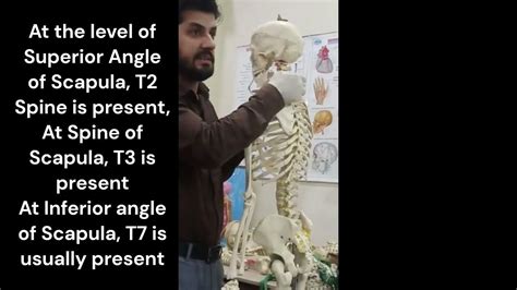 Cervical Spine Palpation Anatomy Landmarks Palpation C7 T1