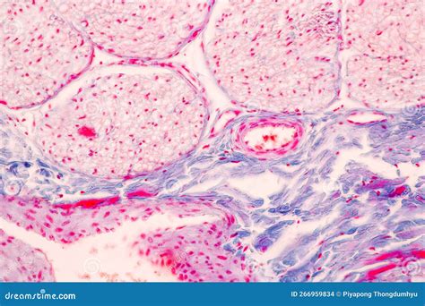 Characteristics Tissue Of Olfactory Epithelium Human Under The