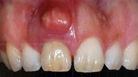 Edith Groenendijk Auf Linkedin Team Work Job Fun