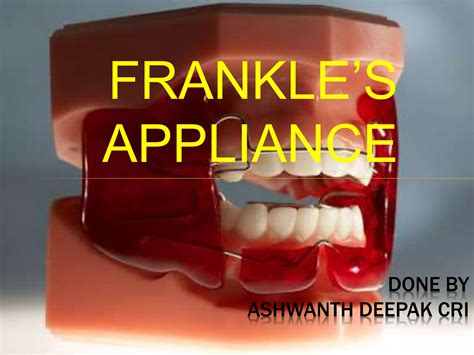 Frankels Appliance Pptx