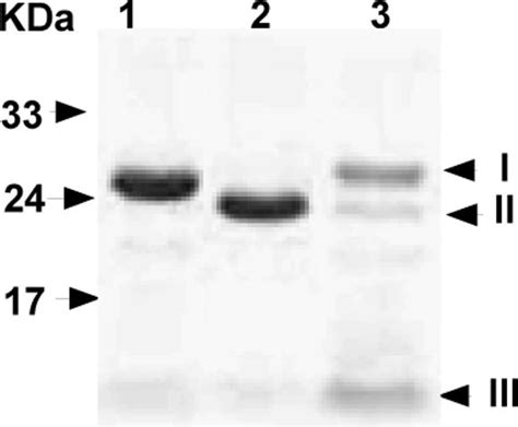 Differential Inactivation Of Polymorphic Variants Of Human O6