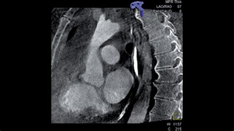 Syngo Dynact Technologie