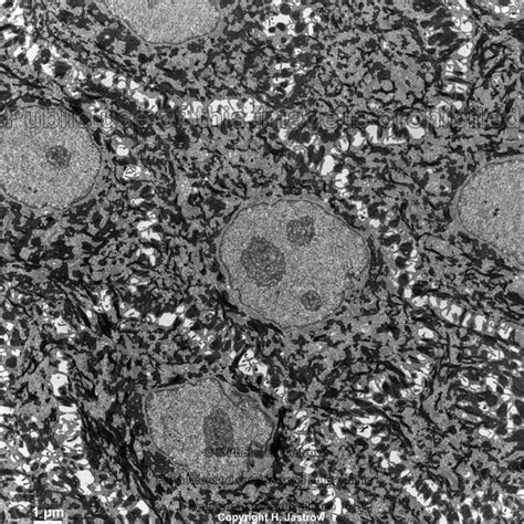 Skin Drjastrows Electron Microscopic Atlas