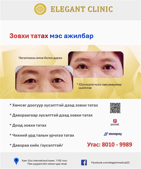 Элегант ️ Элегант эмнэлэгийн чадварлаг найрсаг хамт олон зовхины бүх төрлийн гоо сайхны мэс