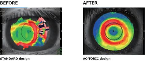 Menicon Alpha Ortho K