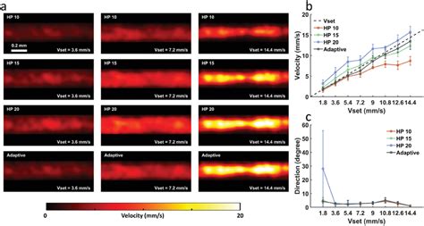 flow phantom validation for hvμdi a flow velocity maps obtained using