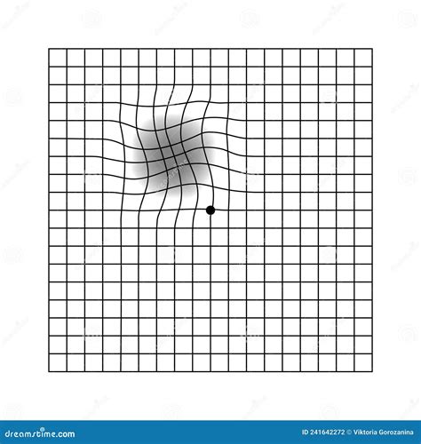 Amsler Grid