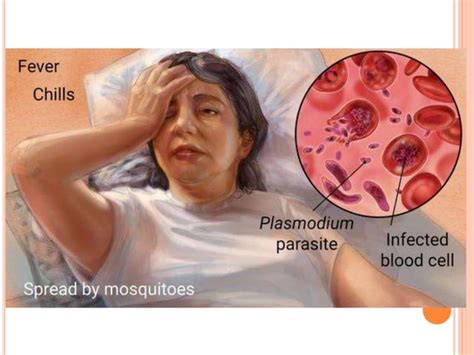 Malaria Pptx Infectious Diseases Diseases And Conditions