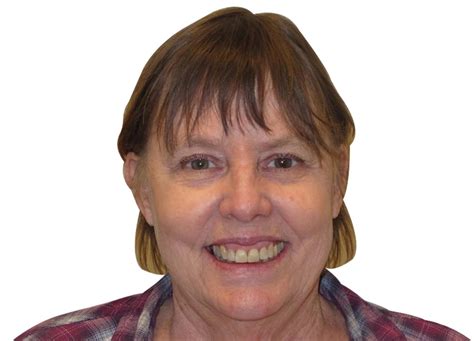 Get A Free Nintendo Switch With Braces Significance Orthodontics