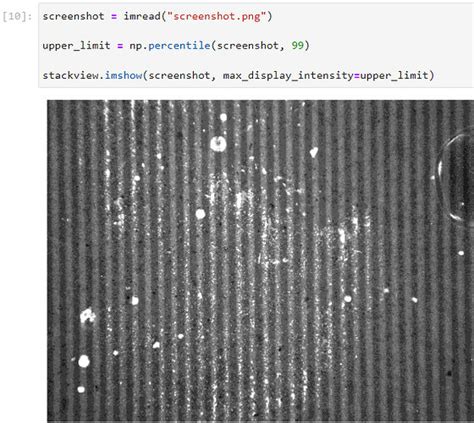 Microscopic Blur Detection Using Laplacian Image Analysis Image Sc Forum