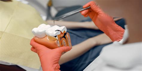 Overview Your Dental Budget And Root Canal Treatment Costs