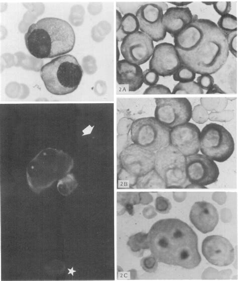Figure 1 From Nucleolus Associated Localization Of J Chains In Igg 1 X Producing Myeloma Cells