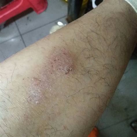挠痒痒照片越挠越痒 千图网