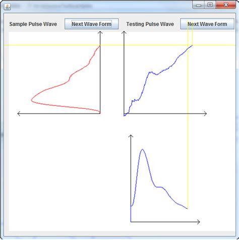 Pulse Wave Analysis IntechOpen