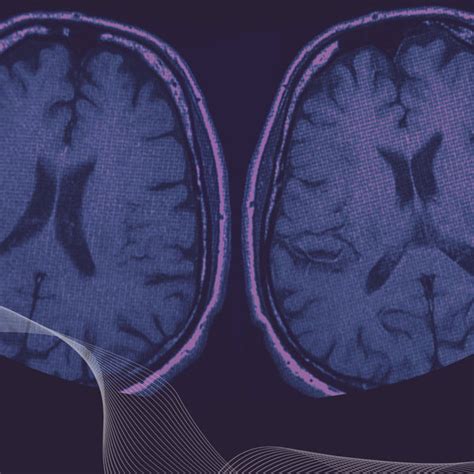 Predicting Your Brain Age With Portable Eeg And Machine Learning Muse