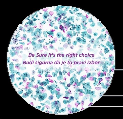 Bd Surepath Liquid Based Pap Test Beo Lab Laboratorije