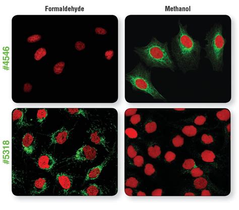 Successful Immunofluorescence Fixation And Permeabilization