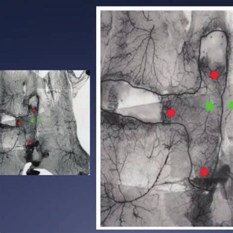 The Angiosomes Of The Head And Neck Study Of A 20 Week Old Fetus A