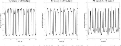 Figure 1 From Development Of A Neurodegenerative Disease Gait Classification Algorithm Using