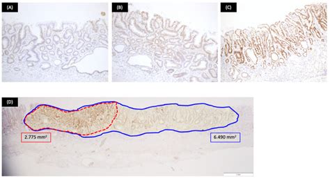Example Of Stain Interpretation A Staining Intensity Point Download Scientific Diagram