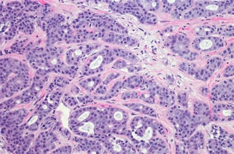 헤마톡실린 에오진 염색 이미지 스톡 사진 및 일러스트 Istock