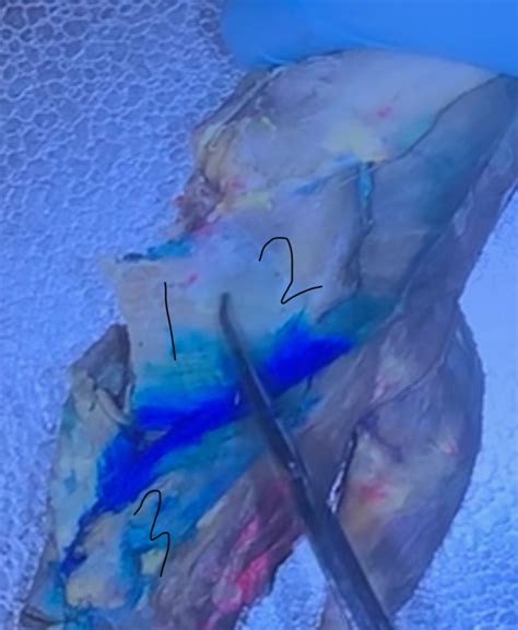 Quiz 5 Review Mink Dissection Lab Pictures 33 Diagram Quizlet