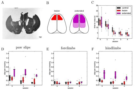 Extended Frontoparietal Cortex Lesions Perform As Well As Control Download Scientific Diagram