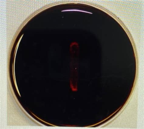 Solved Is This Result Positive Or Negative In A Starch