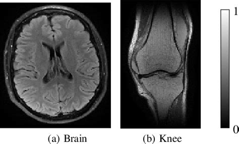 Figure From A Complex Quasi Newton Proximal Method For Image Reconstruction In Compressed