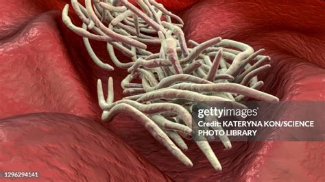 What Is Round Worm Photos And Premium High Res Pictures Getty Images