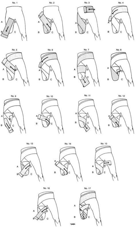 Fig Transtibial Residual Limb Oandp Digital Resource Library 44 Off
