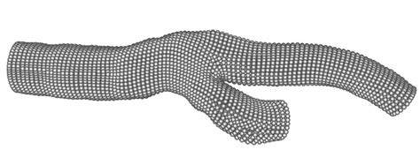 sph model of carotid artery bifurcation created by multiblock approach