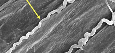Cses 5500 Exam 2 Flashcards Quizlet