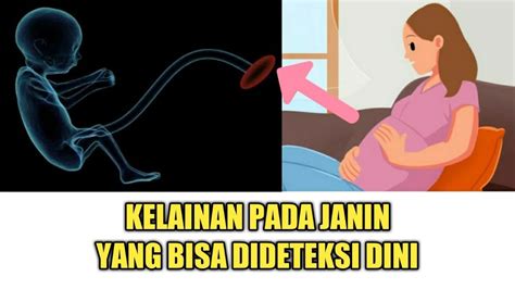 Kelainan Pada Janin yang Bisa Diketahui Ibu Hamil Sejak Dini - YouTube