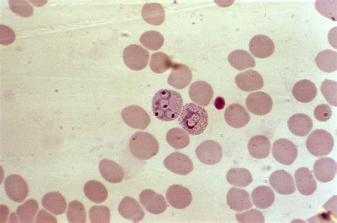 Plasmodium Vivax Images