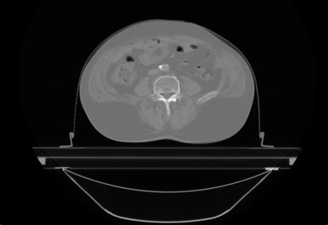 the problem of dicom viewer flair fluka user forum