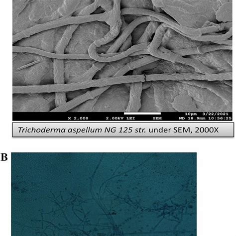 A Sem Image Of Trichoderma Asperellum 2000× B Compound Microscopic Download Scientific Diagram