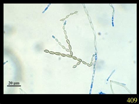 Ppt Phaeohyphomycosis Powerpoint Presentation Free Download Id6314072