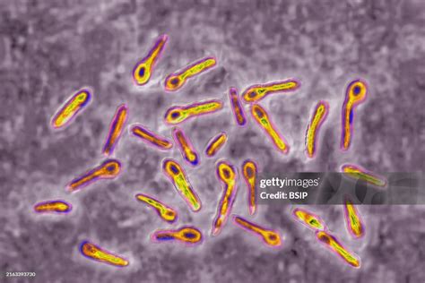 Clostridium Tetani Is The Bacteria Responsible For Tetanus Even