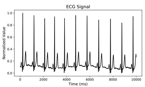 Ecg Heartbeat Classification With Convolutional Neural Network By