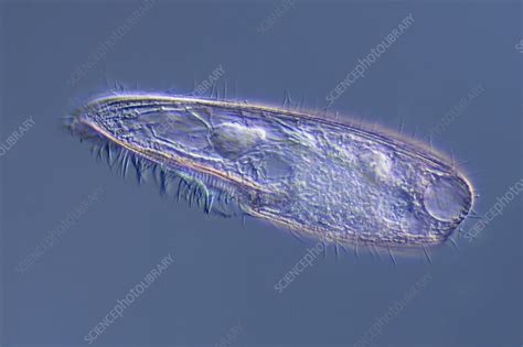 Blepharisma Protozoan Light Micrograph Stock Image C051 1201 Science Photo Library