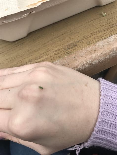 Tiny Green Bug In Ottawa Ontario Rwhatsthisbug